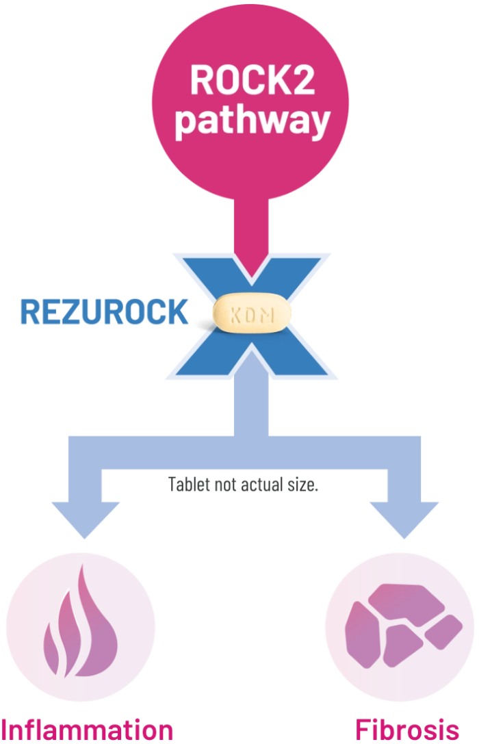 How REZUROCK® (belumosudil) Works Differently