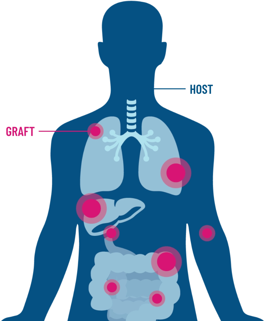 How REZUROCK® (belumosudil) Works Differently